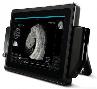 Sonomed A/B Scan Vu-Pad Ocular Ultrasound Machine | Lease/Finance or Buy